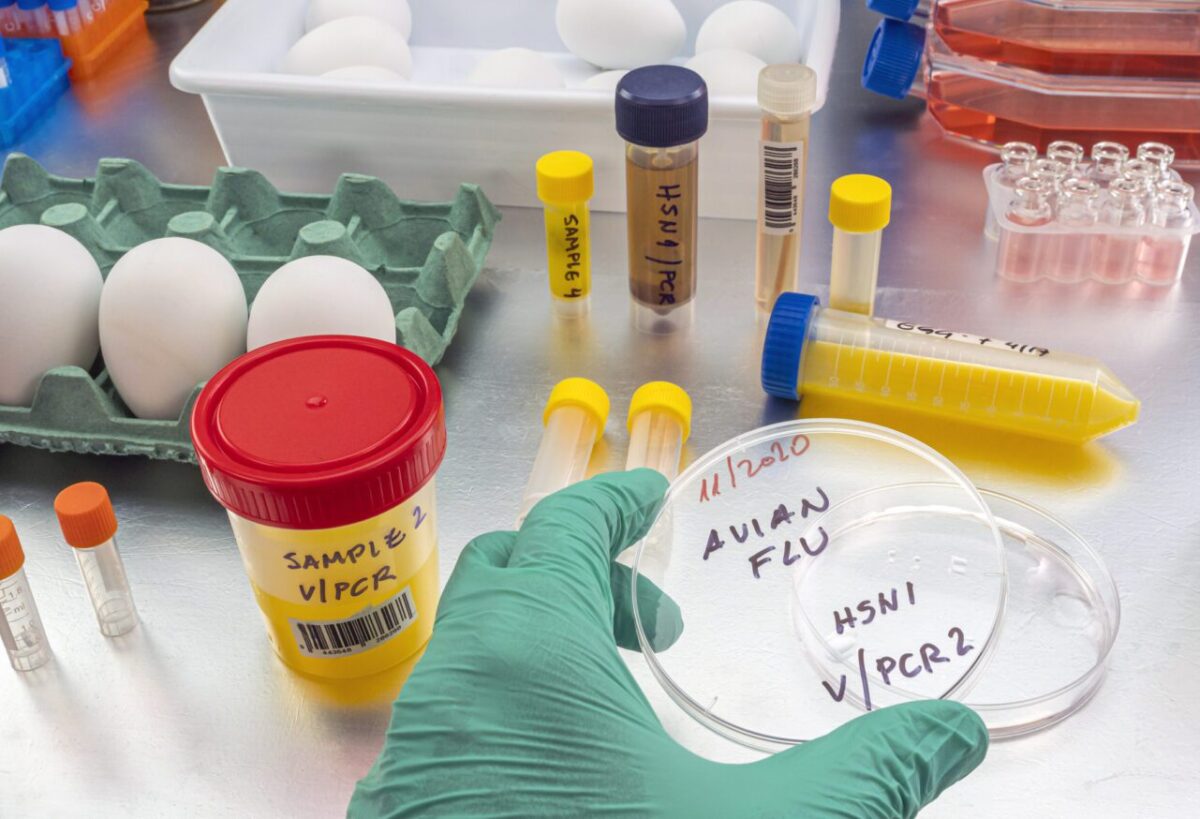 What to know about the bird flu outbreak in the US
